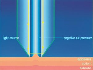 Cutometer - Skin Elasticity Measurement Device | Agaram India
